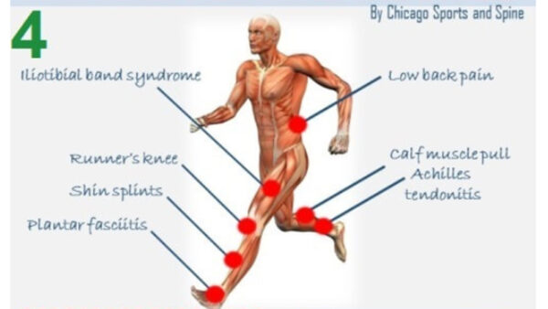 In beeld: meest voorkomende blessures (+ wat doe je eraan?) - RunningBE